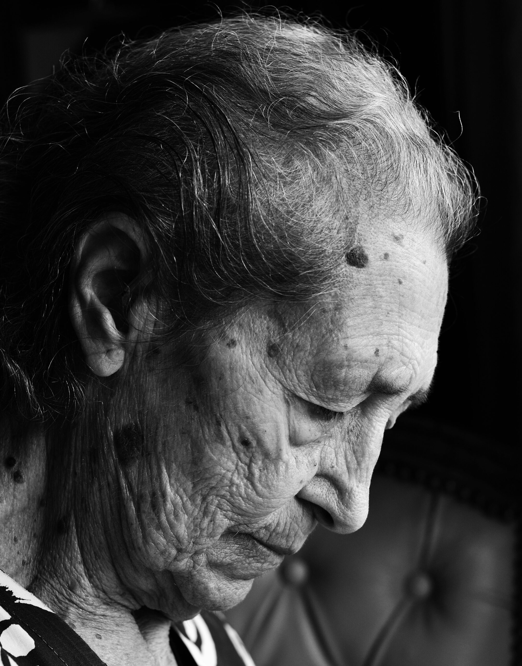 Caregiver Worried That Mom with Late-Stage Alzheimer’s Sleeps All Day ...